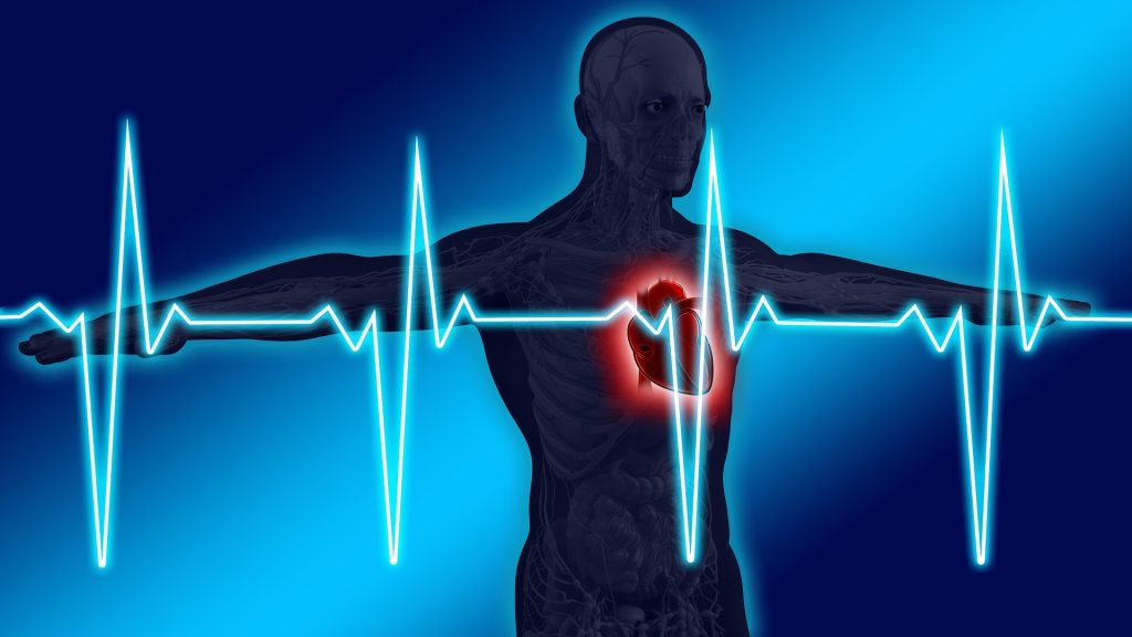 Quels sont les symptômes de l’arythmie cardiaque ? 🫀
